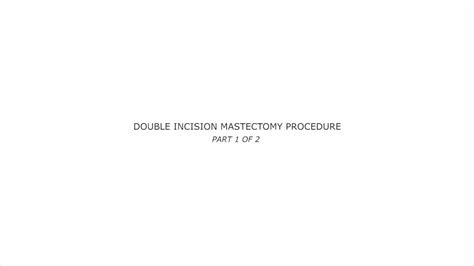 Double Incison Mastectomy For Female To Male Sex GRAPHIC Video RealSelf