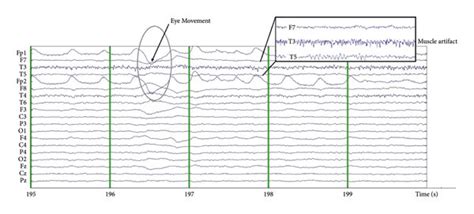 Example Of An Eeg Signal Contaminated With Noise Download Scientific Diagram