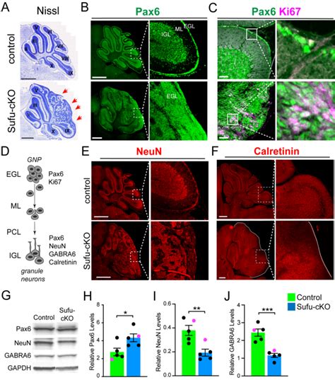 Cerebellar Granule Neuron Precursors Fail To Differentiate And Continue Download Scientific