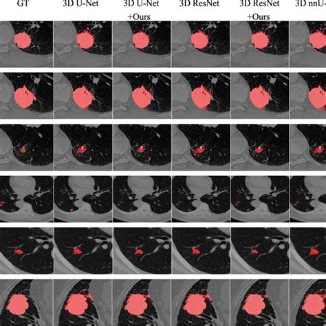 Segmentation Results With Other Compared Models On The Public Dataset
