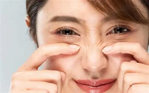 Blackhead Vs Whitehead What S The Difference Florida Independent