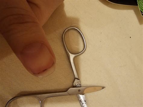 Should I Get A Tetanus Shot R Firstaid