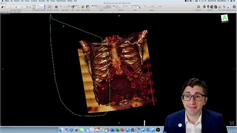 Ct Scan Data To 3d Model At Stephen Jolly Blog