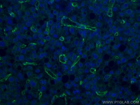 Cd31 Antibody 66065 2 Ig Proteintech