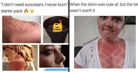 35 Funny Sunburn Memes For Us Pale Skinned Summer Warriors Who Dont