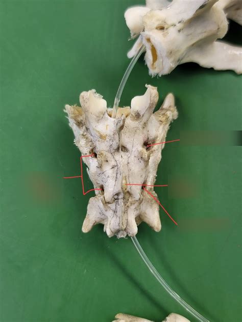 Sacral Diagram Quizlet