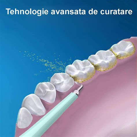 Професионален уред за почистване на зъбите Siks премахване на зъбен камък водоустойчив 5