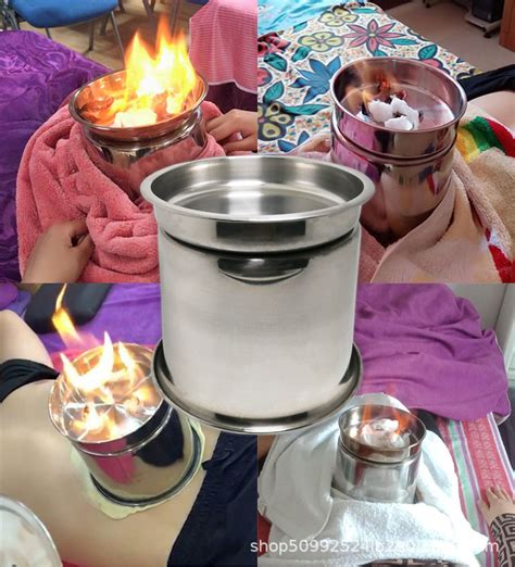 温阳灸不锈钢火罐通经络美容院家用祛湿祛寒暖宫仪肩颈腰背龙骨罐 阿里巴巴
