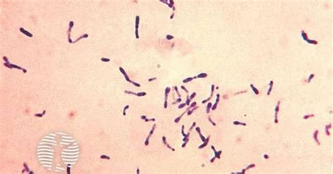 Corynebacterium Diphtheriae Gram Stain Image