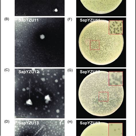 A Electron Microscopy And B Plaque Morphology Of S Aureus Phages Download Scientific