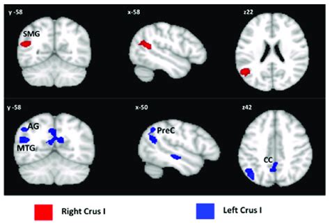 Patterns Of Cerebellar Fc With The Cerebral Cortex Seed To Voxel Download Scientific Diagram