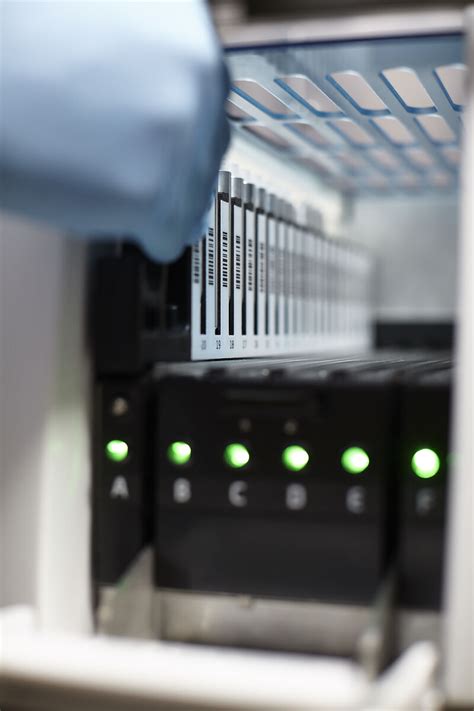 Looking For A Reliable Way To Measure Prolactin To Diagnose