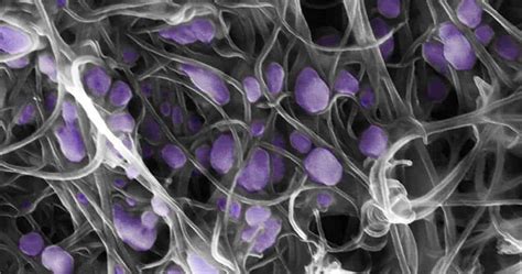 Contagion Using Mathematical Models To Save Lives Maths Careers