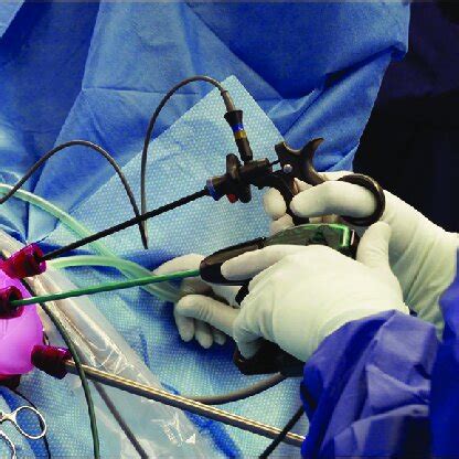 Self Constructed Multichannel Single Site Port Device For Vaginal Download Scientific Diagram