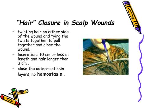 PPT Wound Management In ED PowerPoint Presentation Free Download ID 1241829