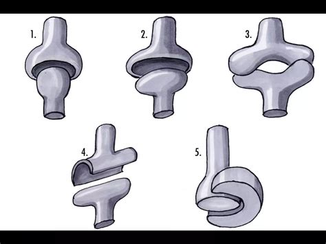 Jaw Dislocation Pptx