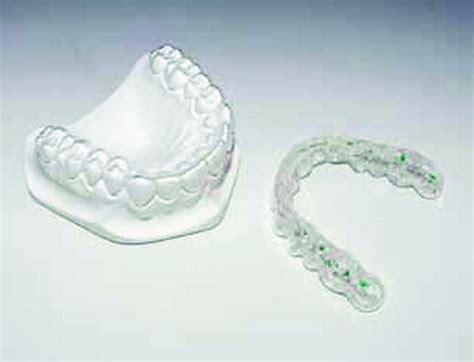 TMJ Splint Digital Focus