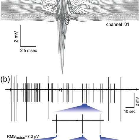 High Resolution Emg Recordings With Micro Cone Meas A Example Download Scientific Diagram