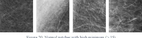 Figure 1 From Interpretability Approaches For A Breast Lesion Detection