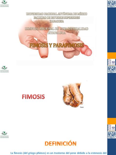 Fimosis Y Parafimosis Pdf Anatomia Sexual Urología