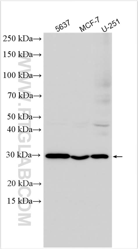 TRMT A Antibody AP Proteintech