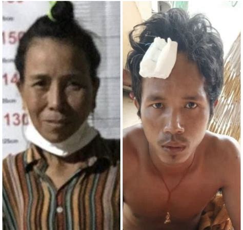 បុរសម្នាក់ផឹកចំស្រារករឿងត្រូវគេកាប់ដេរ១០ថ្នេរ សារព័ត៌មាន នគរវត្ត