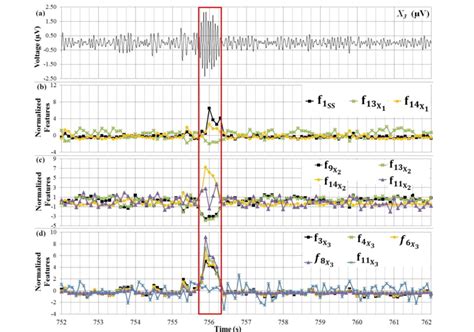 Sleep Spindle Eeg Characterization The Visual Mark Form An Expert Download Scientific Diagram