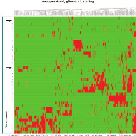 heat map of unsupervised clustering of the four groups by spotfire