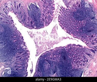 Appendix Light Micrograph Stock Photo Alamy