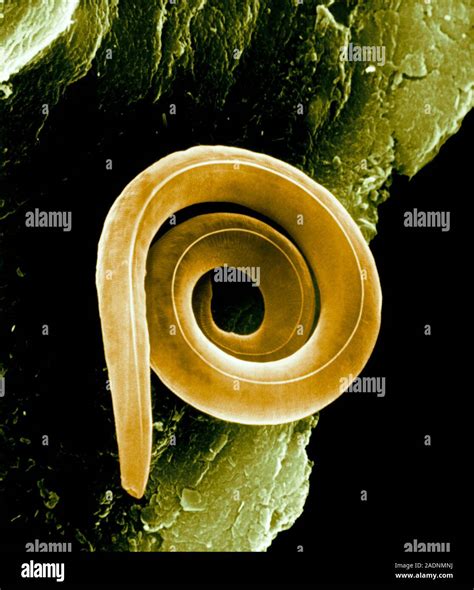 unsegmented worm