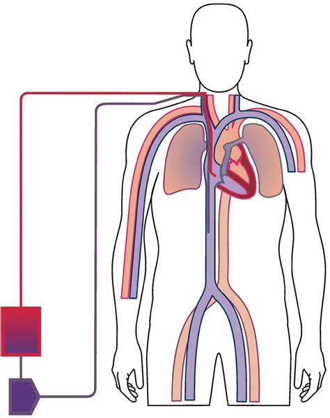 Configurations Of Ecmo Alfred Ecmo Guideline