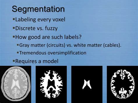 Segmentation In Image Processing Methods Useful To Diagnosis Of Diseases Ppt