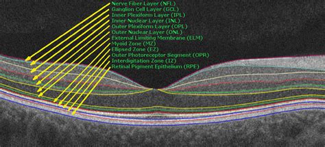 OCT Retinal Image With Its Distinctive 12 Layers For A Typical Healthy