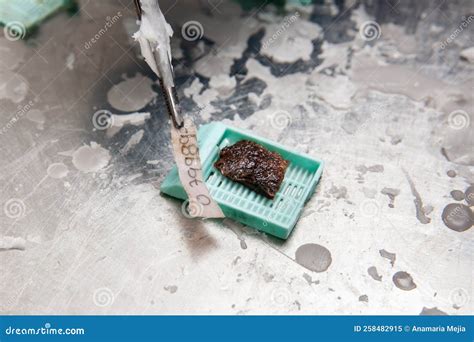 Label Used To Identify The Biopsy Sample Scientist Embedding Tissues In Paraffin Blocks For