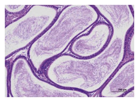 Pathological Observation Of Epididymis Epididymis Tissues Obtained At Download Scientific