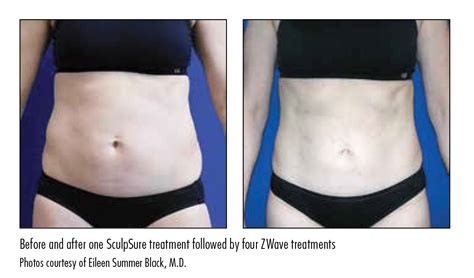 Z Wave By Zimmer SepiSpa