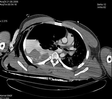 Keep It Simple And Straightforward Healthcare In Europe Com