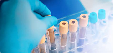 Genetic Testing For Infertility What You Need To Know