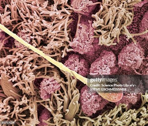 Electron Scan Photos And Premium High Res Pictures Getty Images