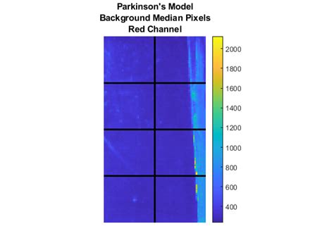 Visualizing Microarray Data Matlab And Simulink