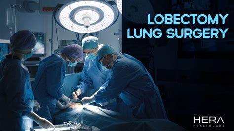 A Lobectomy Is A Surgery Done To Treat Lung Cancer By Removing One Or Two… Hera Healthcare