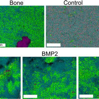 EDX Chemical Mapping Of New Zealand Rabbit Femur Bone Control Download Scientific Diagram