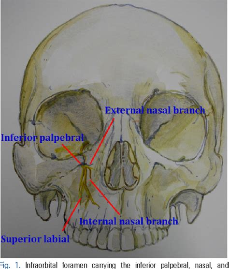 Figure 1 From Accessory Infraorbital Foramen Location Using Cone Beam Computed Tomography