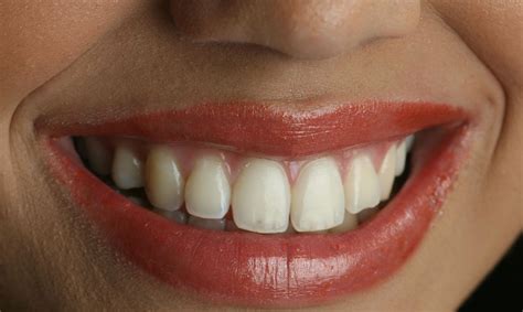 These Foods Promote The Development Of Optimal Oral Health Kumneger Media