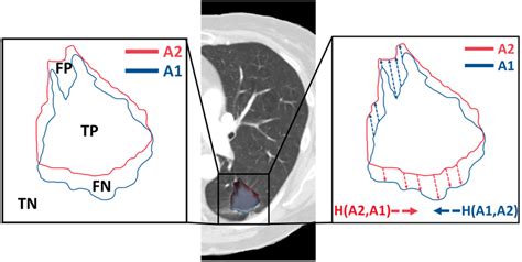 Schematic Illustration For The Evaluation Metrics Calculation