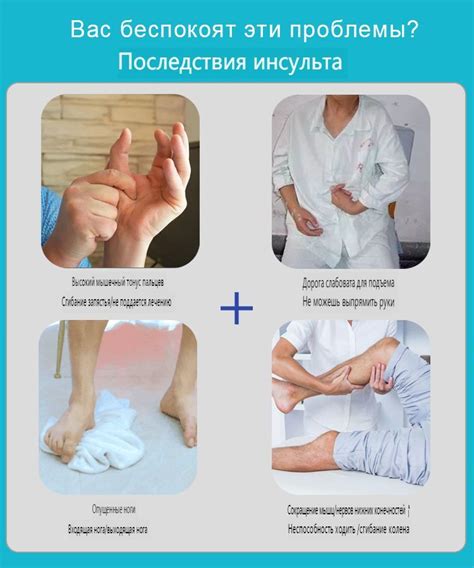 Тренажер для реабилитации рук при гемиплегии после инсульта Упражнение для восстановления