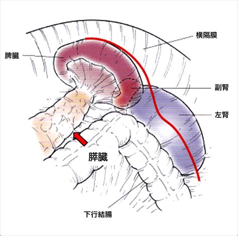 東海大学医学部外科学系腎泌尿器科学 ロボット支援副腎摘除術