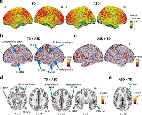 Atypical Intrinsic Neural Timescale In Autism Elife