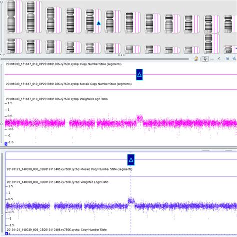 A Chromosomal Microarray Analysis Cma Array On Uncultured