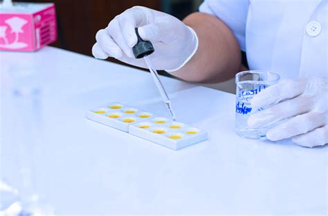 핸드의 과학자 또는 연구원 실험실 과학에서에서 흰 접시로 비 커에서 붉은 화학 물질을 Dropper를 사용 하 여 라텍스 장갑 착용 Stem 주제에 대한 스톡 사진 및 기타